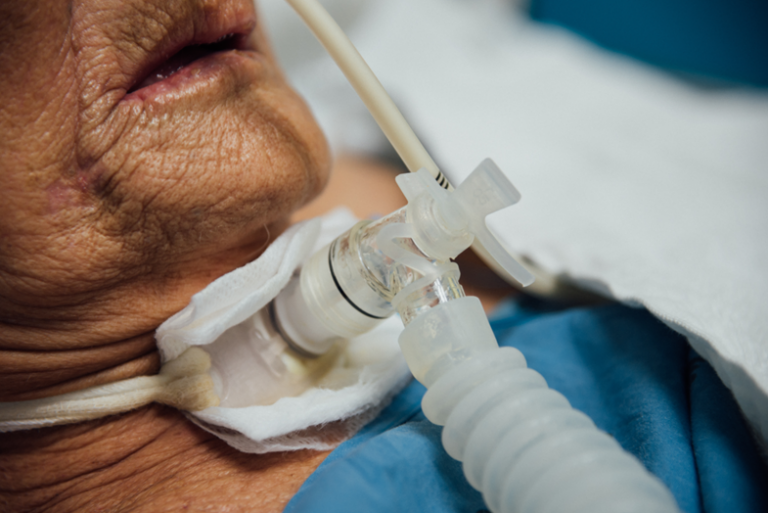 Tackling Critical Airway Obstruction: The Life-Saving Procedure of ...